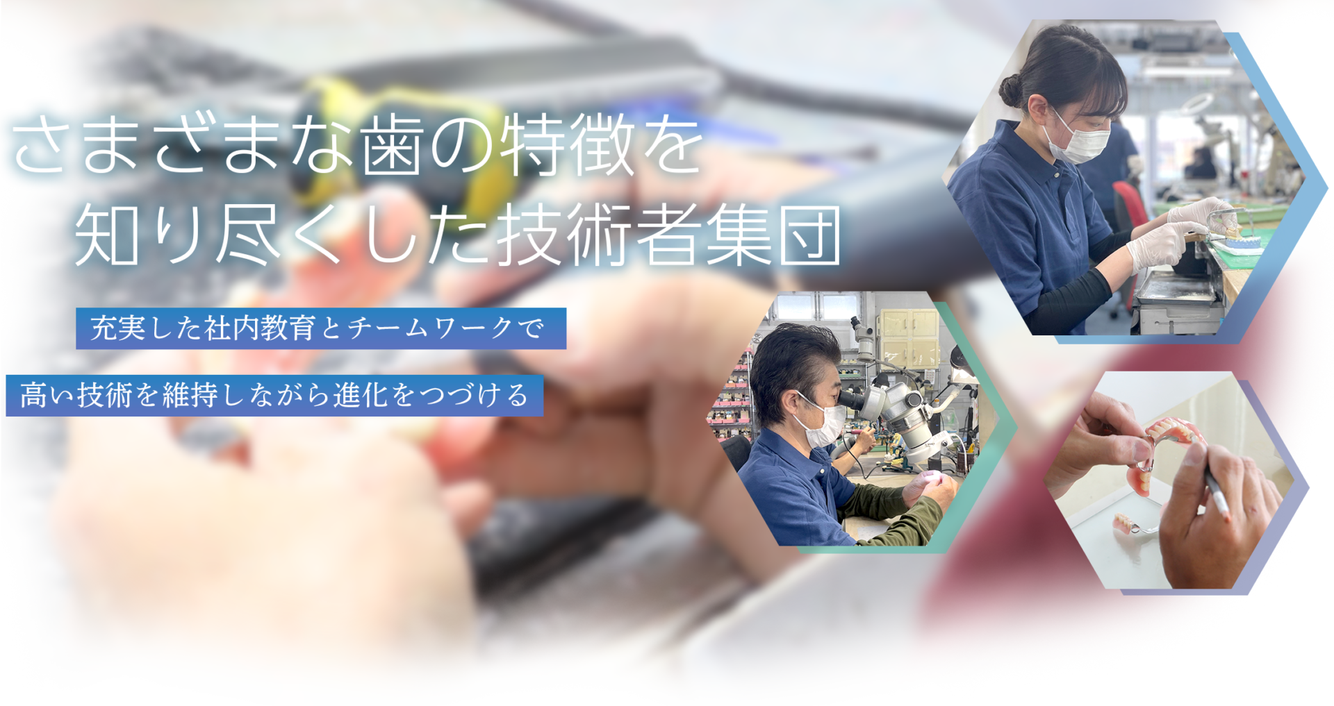 株式会社advex | 技工物 | 歯科技工所